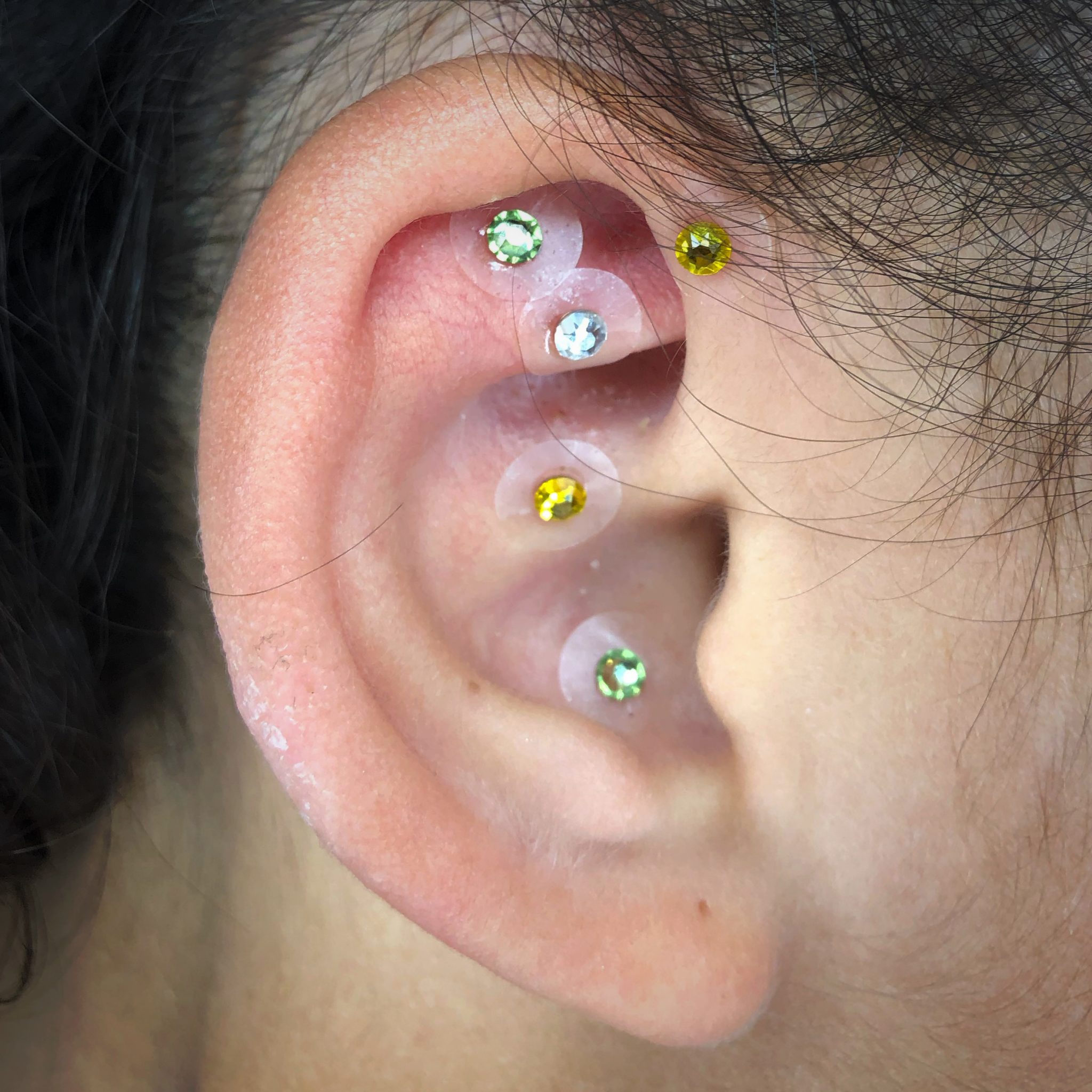 Ear seed images 1 Pure Joy Acupuncture